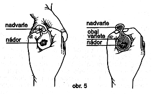 O varlatech a nádorech varlat » Linkos.cz